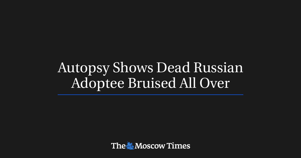 Autopsy Shows Dead Russian Adoptee Bruised All Over