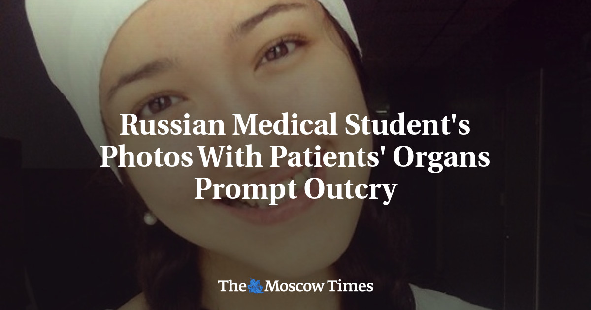 Russian Medical Student's Photos With Patients' Organs Prompt Outcry