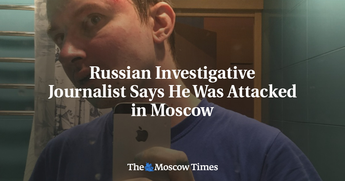 Russian Investigative Journalist Says He Was Attacked in Moscow - The ...
