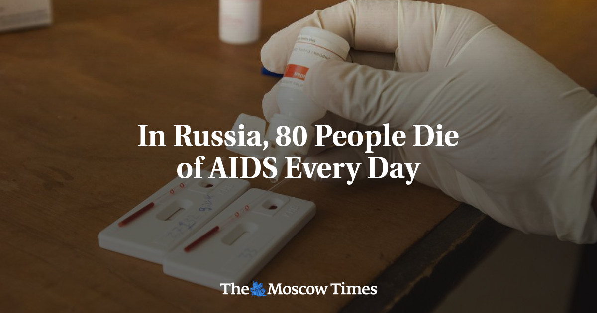 In Russia, 80 People Die of AIDS Every Day