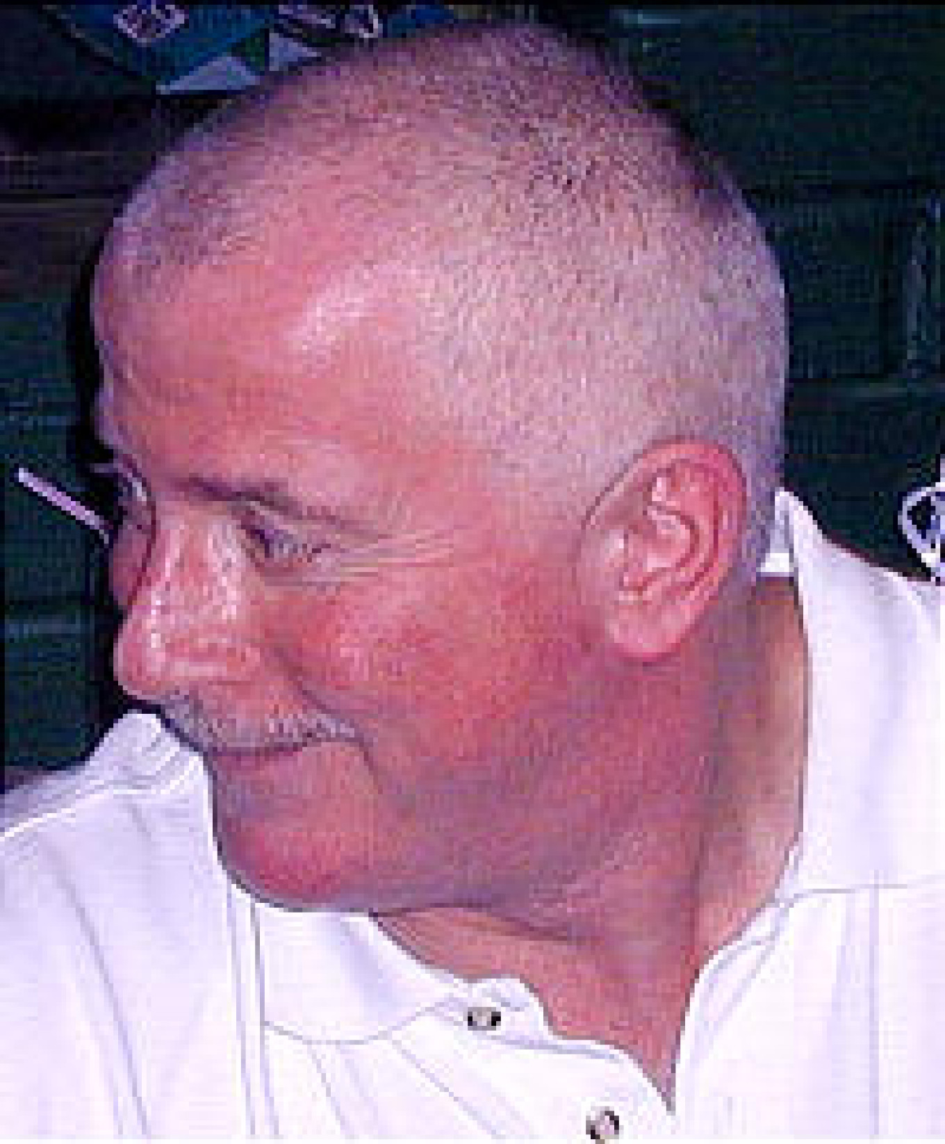 A Moose, a Duck, a Boar and a Clever Canadian